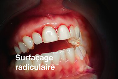 Nos soins - Cabinet dentaire Libération